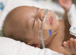 Neotech RAM Cannula India : High-flow Nasal Oxygen Cannula (HFNC)